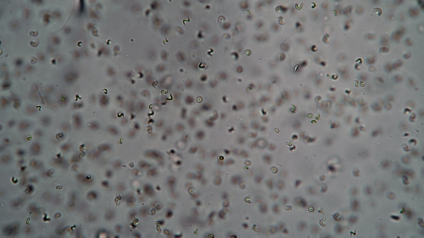 Bacteria under a Microscope image - Free stock photo - Public Domain ...