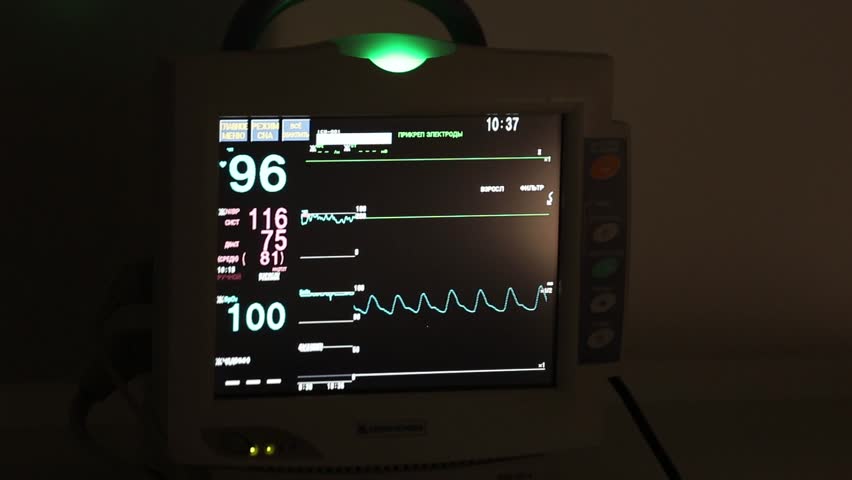 Patients Monitor in Intensive Care Stock Footage Video (100% Royalty ...