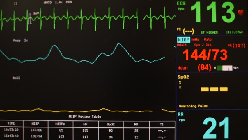 Overall Nurses Station Monitor In The Neonatal Intensive Care Unit ...
