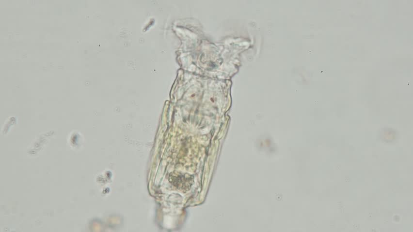 Rotifer Stock Video Footage - 4K and HD Video Clips | Shutterstock
