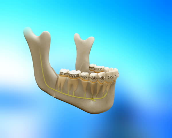 Stock Video Clip of Dental Surgery Animation of Teeth | Shutterstock