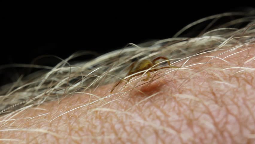 Paralysis Ticks, Also Called Dog Ticks, Shell-back Ticks Or Scrub Ticks ...