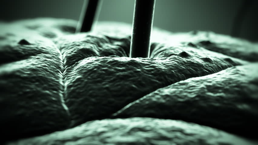 วิดีโอสต็อกของ sem scanning electron microscope photo of | 8265259 ...