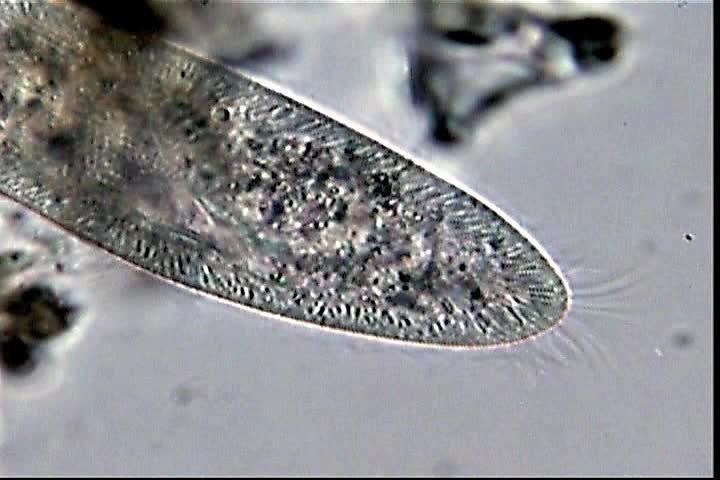A Thick Culture Of The Protozoan Ciliate Spirostomum Stock Footage ...